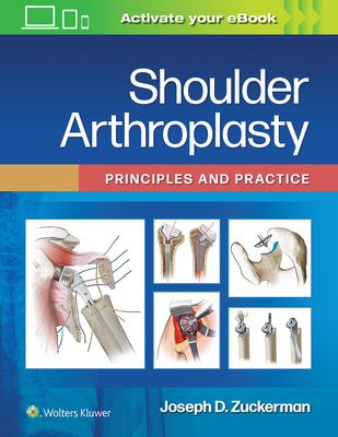 【预订】Shoulder Arthroplasty: Principles and Practice
