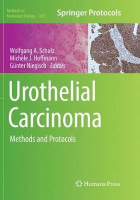 【预订】Urothelial Carcinoma