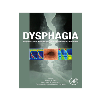 [预订]Dysphagia