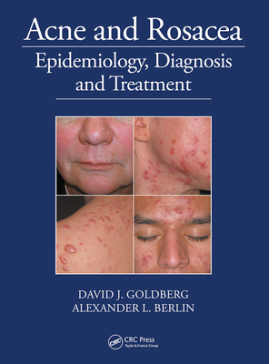 【预订】Acne and Rosacea: Epidemiology, Diagnosis and Treatment