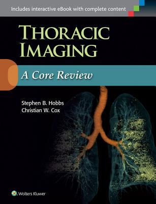 【预订】Thoracic Imaging