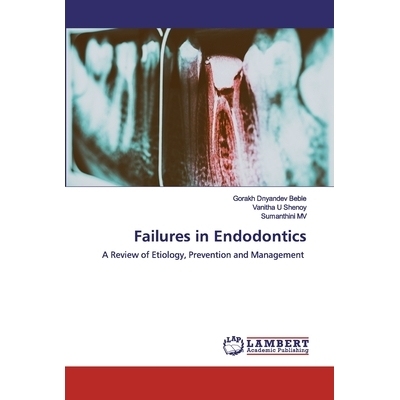 预订 Failures in Endodontics: A Review of Etiology, Prevention and Management: 9786200529862