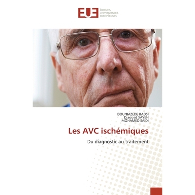 预订 Les AVC ischémiques: 9786209059193