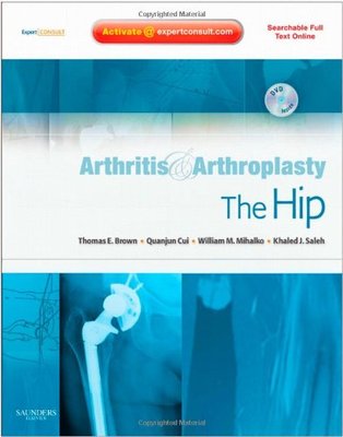 【预订】Arthritis and Arthroplasty
