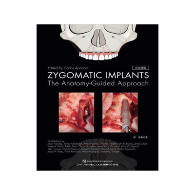 [预订]ZYGOMATIC IMPLANTS The Anatomy‐Guided Approach 9784781209333