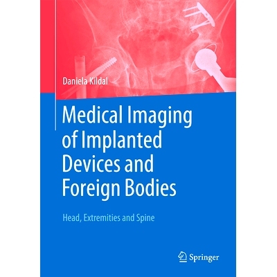 预订 Medical Imaging of Implanted Devices and Foreign Bodies: Head, Extremities and Spine 植入装置与异物的医学成像：头部