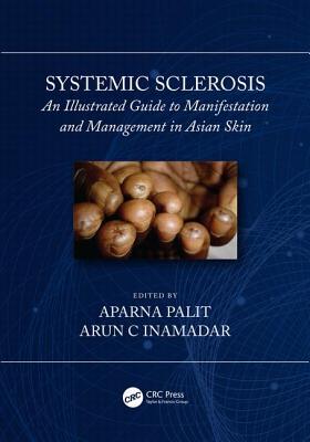 【预订】Systemic Sclerosis: An Illustrated Guide to Manifestation and Management in Asian Skin