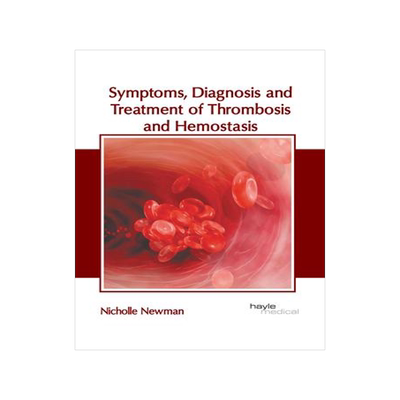 [预订]Symptoms, Diagnosis and Treatment of Thrombosis and Hemostasis 9781646475674