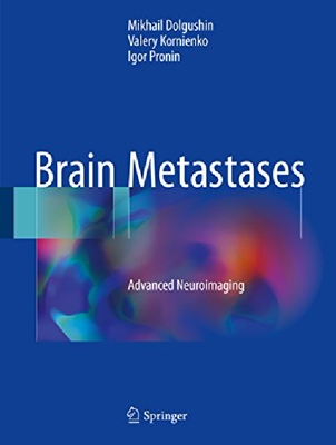 【预订】Brain Metastases: Advanced Neuroimag...