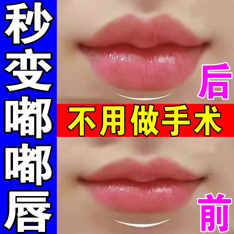 丰唇精油嘟嘟唇神器饱满精华唇珠嘴唇变厚去除改善唇周发黑淡化
