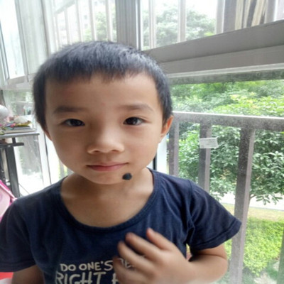 黑色化妆硅胶痦子瘊子媒婆道具