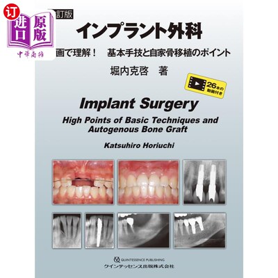 海外直订日语 インプラント外科　動画で理解！基本手技と自家骨移植のポイント インプラント外科　動画で理解！基本手技と