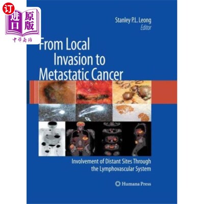 海外直订医药图书From Local Invasion to Metastatic Cancer