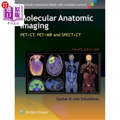 海外直订医药图书Molecular Anatomic Imaging: Pet/Ct, Pet/MR and Spect CT 分子解剖成像:Pet/Ct, Pet/MR和Spect Ct