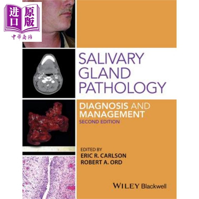 现货 涎腺病理学 诊断与管理 Salivary Gland Pathology 英文原版 Eric Carlson 【中商原版】Wiley