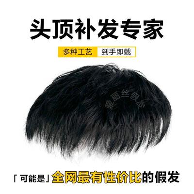 男士假发短发帅气隐形头顶补发块遮白发地中海秃头男式轻薄补发片