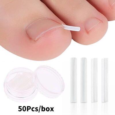 50Pcs Ingrown Toenail Correction Tool Ingrown Toe Nail Treat