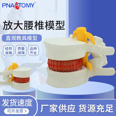 仿真人体腰椎间盘挤压模拟演示模型放大脊椎脊柱病变正骨教学