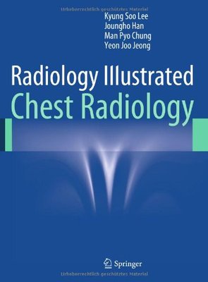 【预订】Radiology Illustrated: Chest Radiology