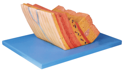 胃壁放大模型GD/A12003