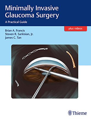 【预订】Minimally Invasive Glaucoma Surgery