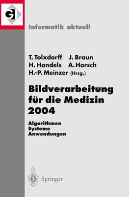 【预订】Bildverarbeitung Fur Die Medizin 200...