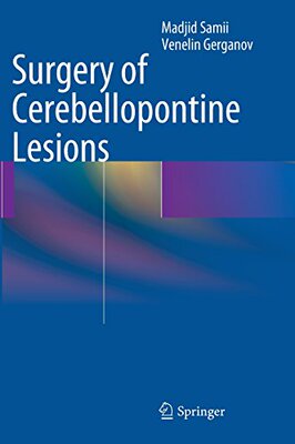 【预订】Surgery of Cerebellopontine Lesions