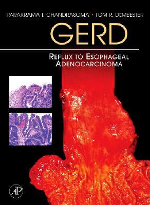 【预售】Gerd: Reflux to Esophageal Adenocarcinoma