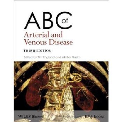【预订】Abc of Arterial and Venous Disease 3...