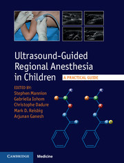 【预订】Ultrasound-Guided Regional Anesthesi...