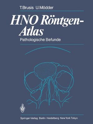 【预订】Hno Rontgen-Atlas: Pathologische Befunde