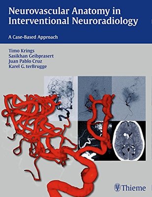 【预售】Neurovascular Anatomy in Interventional Neuror...