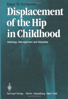 【预售】Displacement of the Hip in Childhood: Aetiology, ...