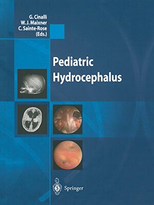 【预订】Pediatric Hydrocephalus