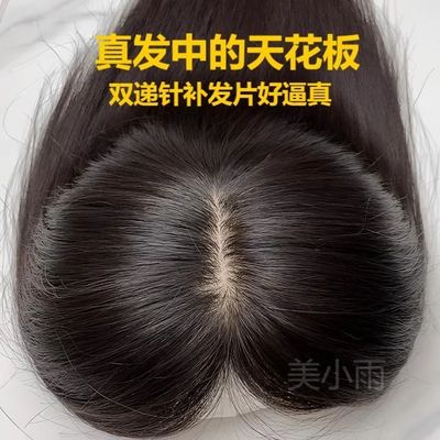 真发假发片双递针头顶补发片一片式遮白发增发量高档隐形无痕透气