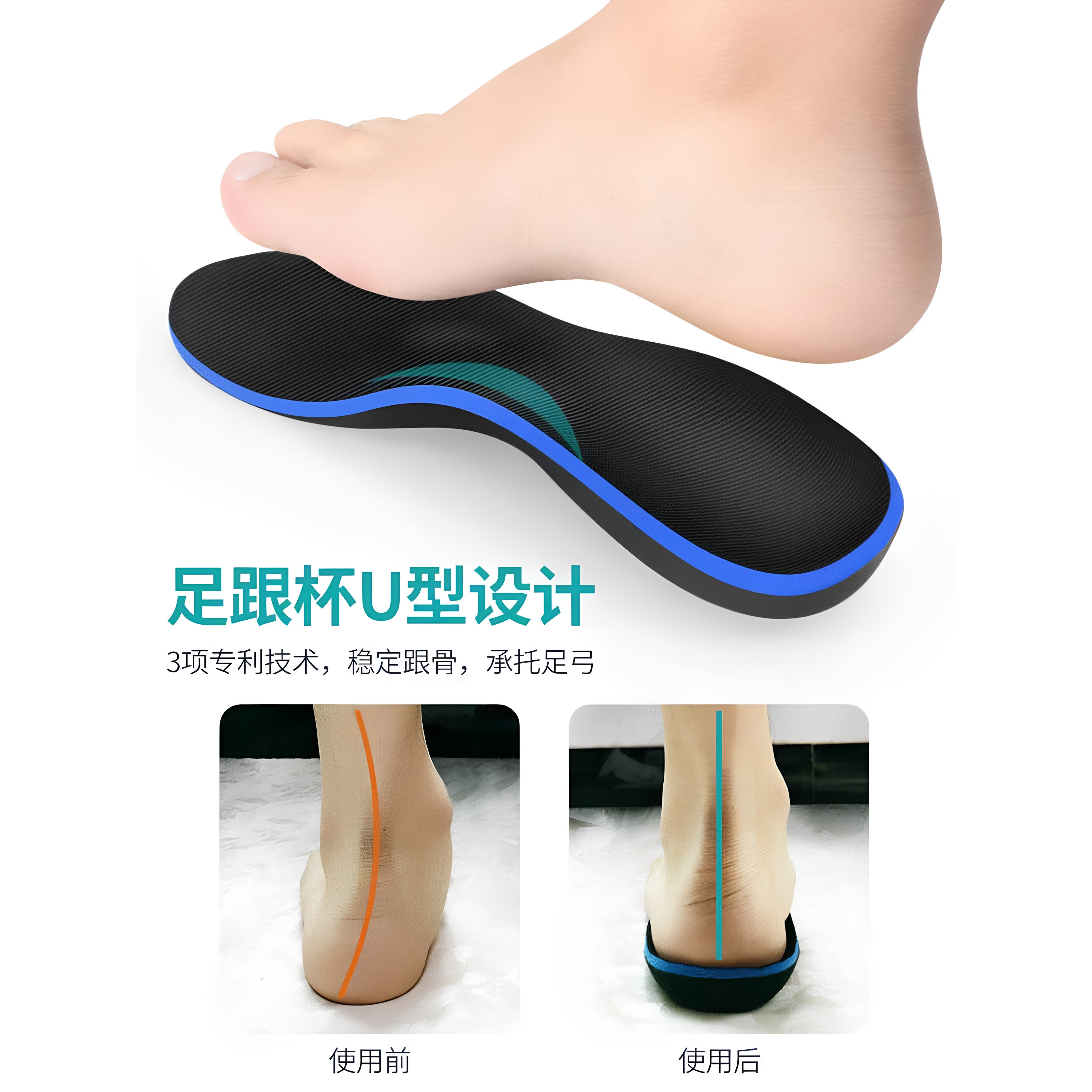 康鱼匠功纺足弓鞋垫+普通鞋垫 +脚型盒卷尺