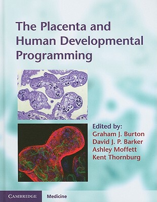 【预售】The Placenta and Human Developmental Programming