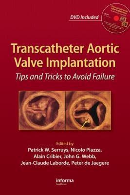 【预售】Transcatheter Aortic Valve Implantation: Tips and