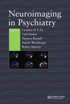 【预售】Neuroimaging in Psychiatry