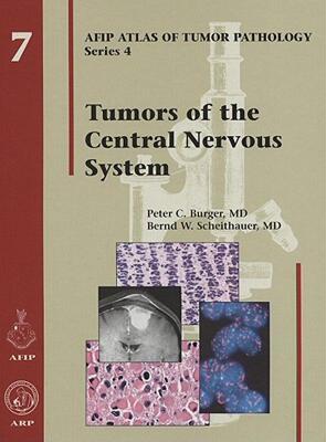 【预售】Tumors of the Central Nervous System