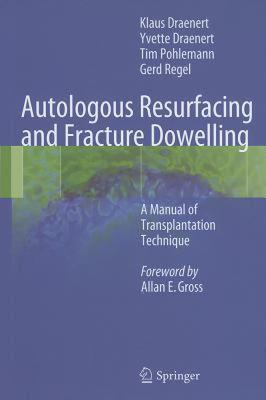 【预售】Autologous Resurfacing and Fracture Dowelling: A
