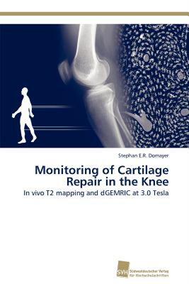 【预售】Monitoring of Cartilage Repair in the Knee