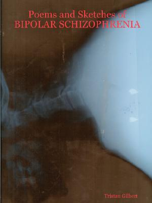【预售】Poems and Sketches of Bipolar Schizophrenia