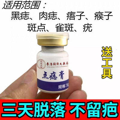 正品脸部膏点古方植物磨痣无痕药水痦子取去黑痣专用神器消除