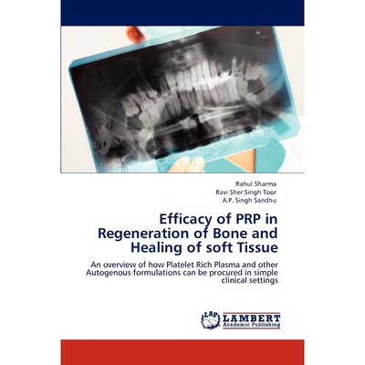 按需印刷不退不换Efficacy of Prp in Regeneration of Bone and Healing of Soft Tissue[9783848445974]