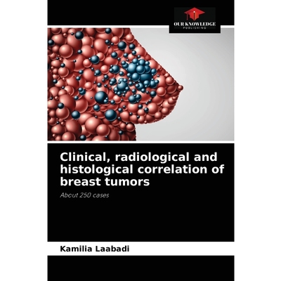 按需印刷Clinical, radiological and histological correlation of breast tumors[9786204046006]