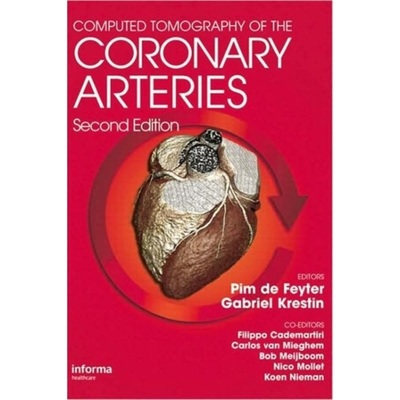 预订Computed Tomography of the Coronary Arteries[9781841846576]