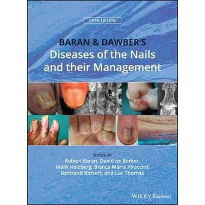 按需印刷不退不换Baran and Dawber's Diseases of the Nails and their Management[9781119323358]