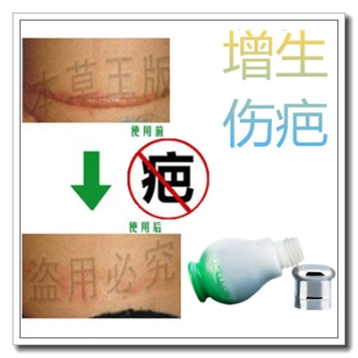 去除儿童凸起伤口贴淡化红印黑色素沉着修复破腹产后刀疤痕灵药膏