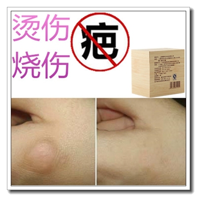 儿童修复膏祛脸烫伤烟疤痕药去增生体质剖宫产线手术凹凸起疙瘩贴